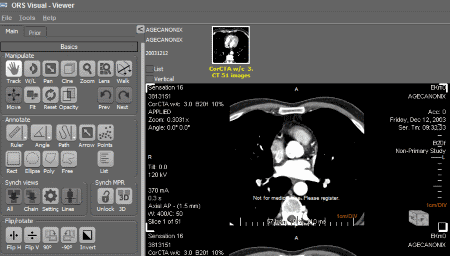 13+ Best Free Windows DICOM Viewer Softwares